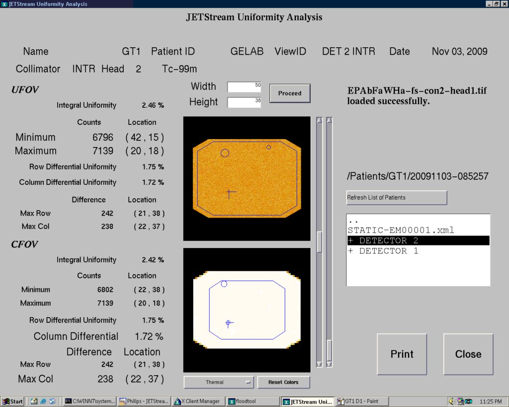 Planar gamma cameras | Gelab Consultores